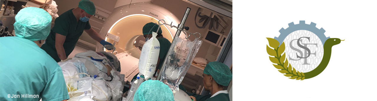 Intraoperative MRI in Neurosurgery - Linköping University